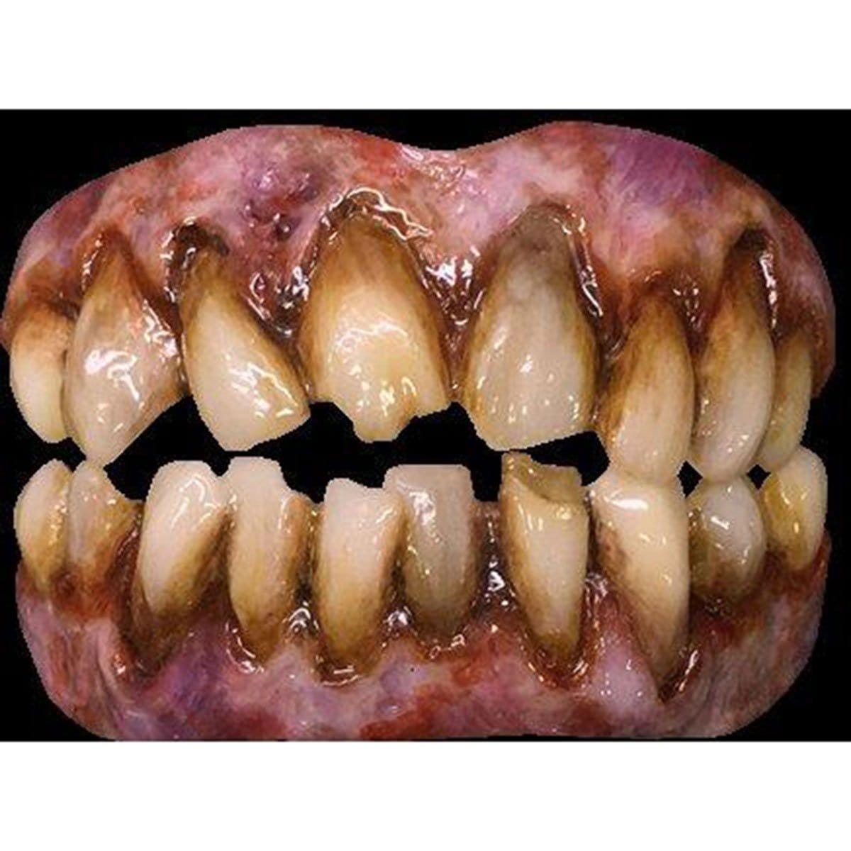 zombie Horror Teeth | Party Expert